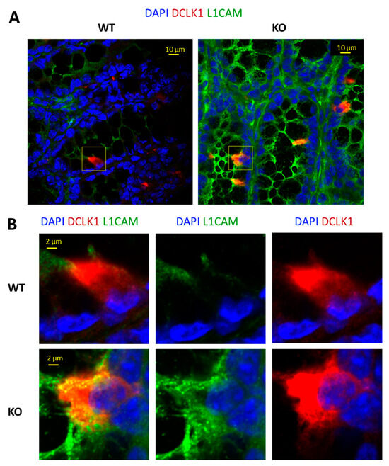 Single-Cell RNA Sequencing (scRNA-seq) Identifies L1CAM as a Key ...