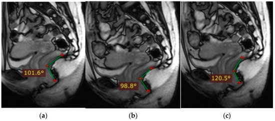 Biomedicines | Free Full-Text | Diagnostic Value of Dynamic Magnetic ...