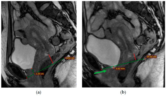 Biomedicines Free Full Text Diagnostic Value Of Dynamic Magnetic Resonance Imaging Dmri Of