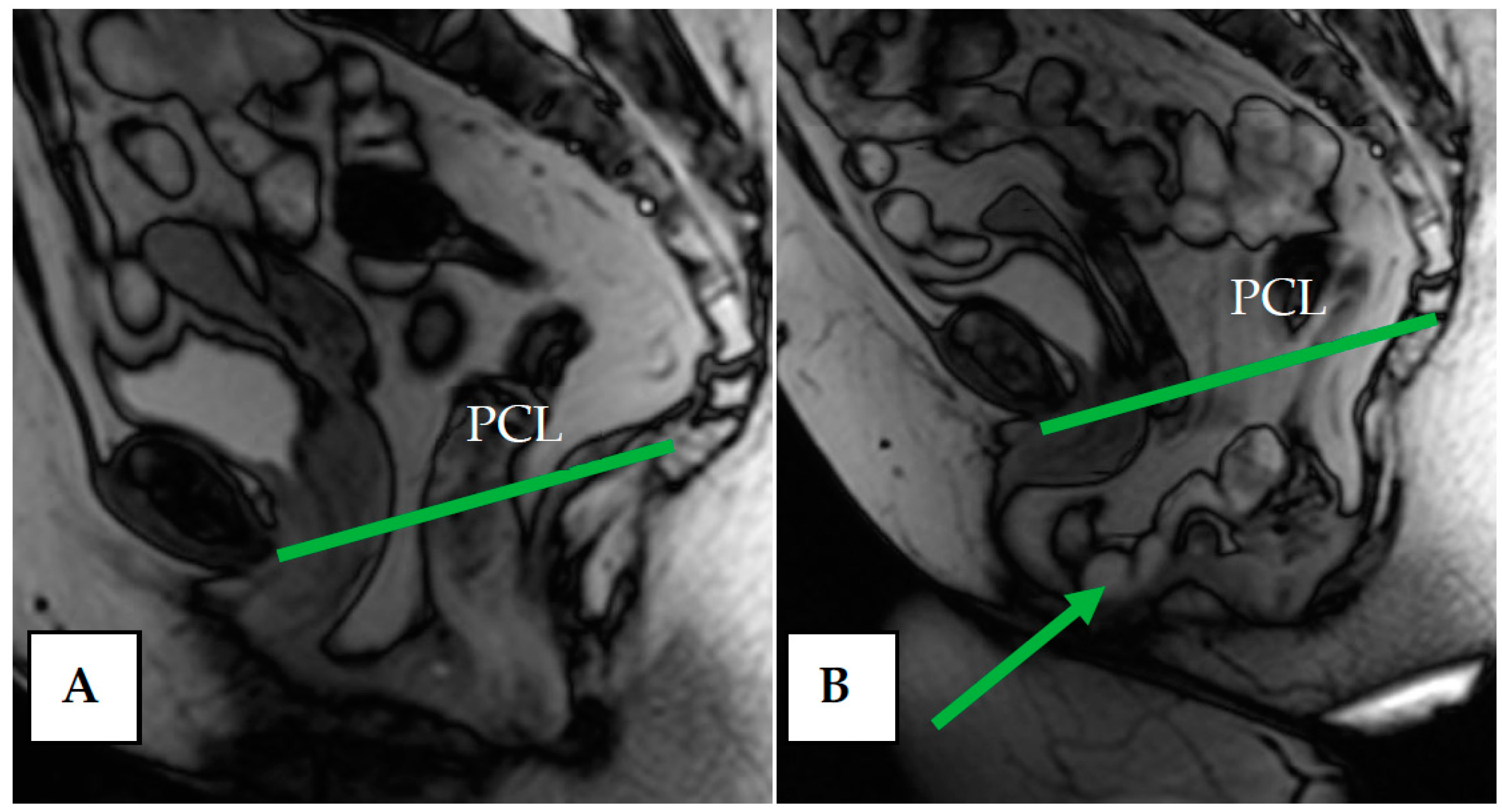Biomedicines Free Full Text Diagnostic Value Of Dynamic Magnetic Resonance Imaging Dmri Of
