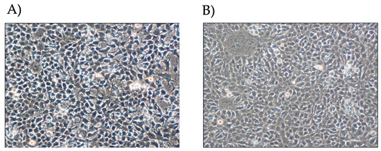 Iron Bioavailability in the Extracellular Environment Is More Relevant ...
