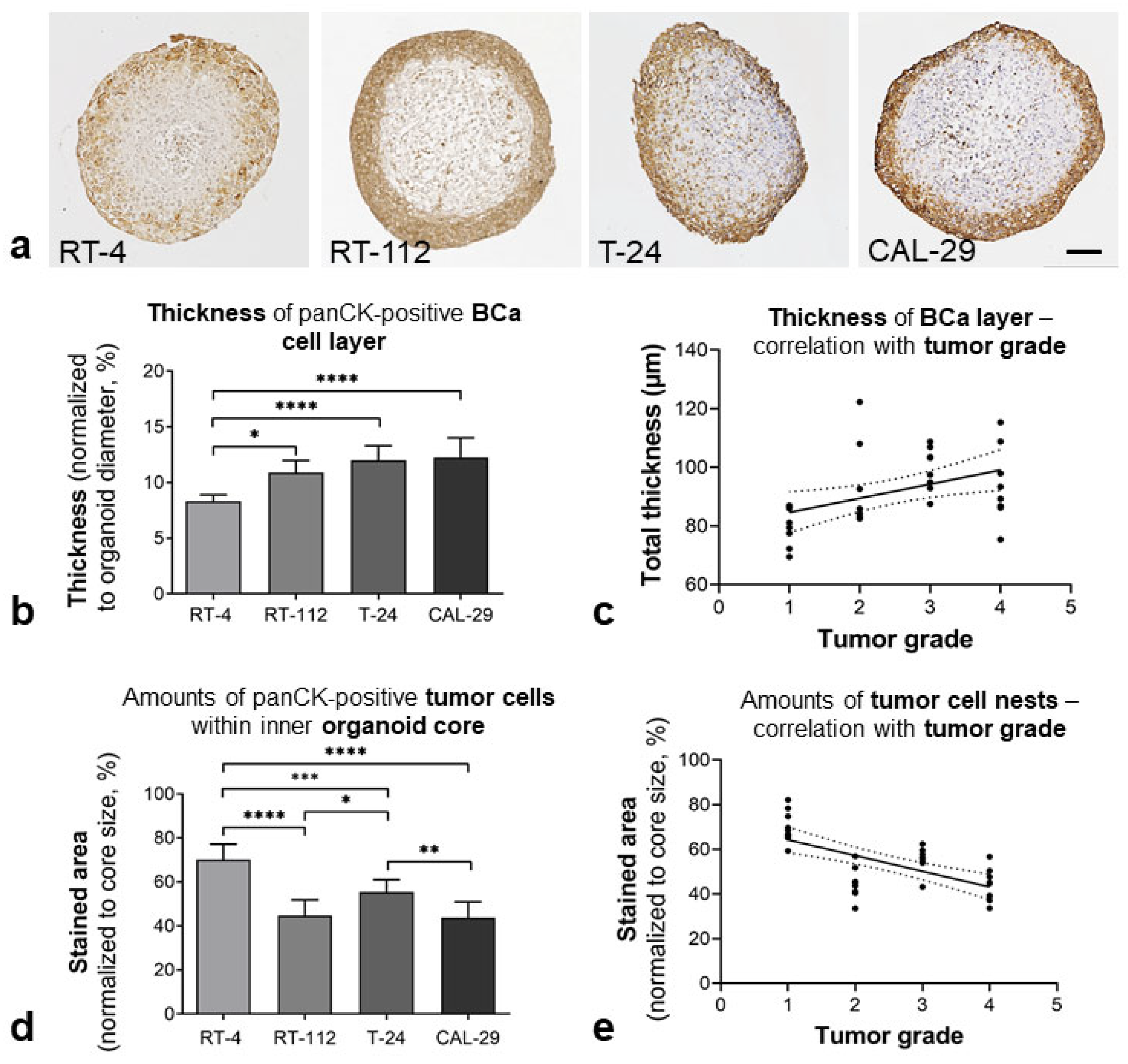 Cell Line-Based Human Bladder Organoids with Bladder-like Self ...