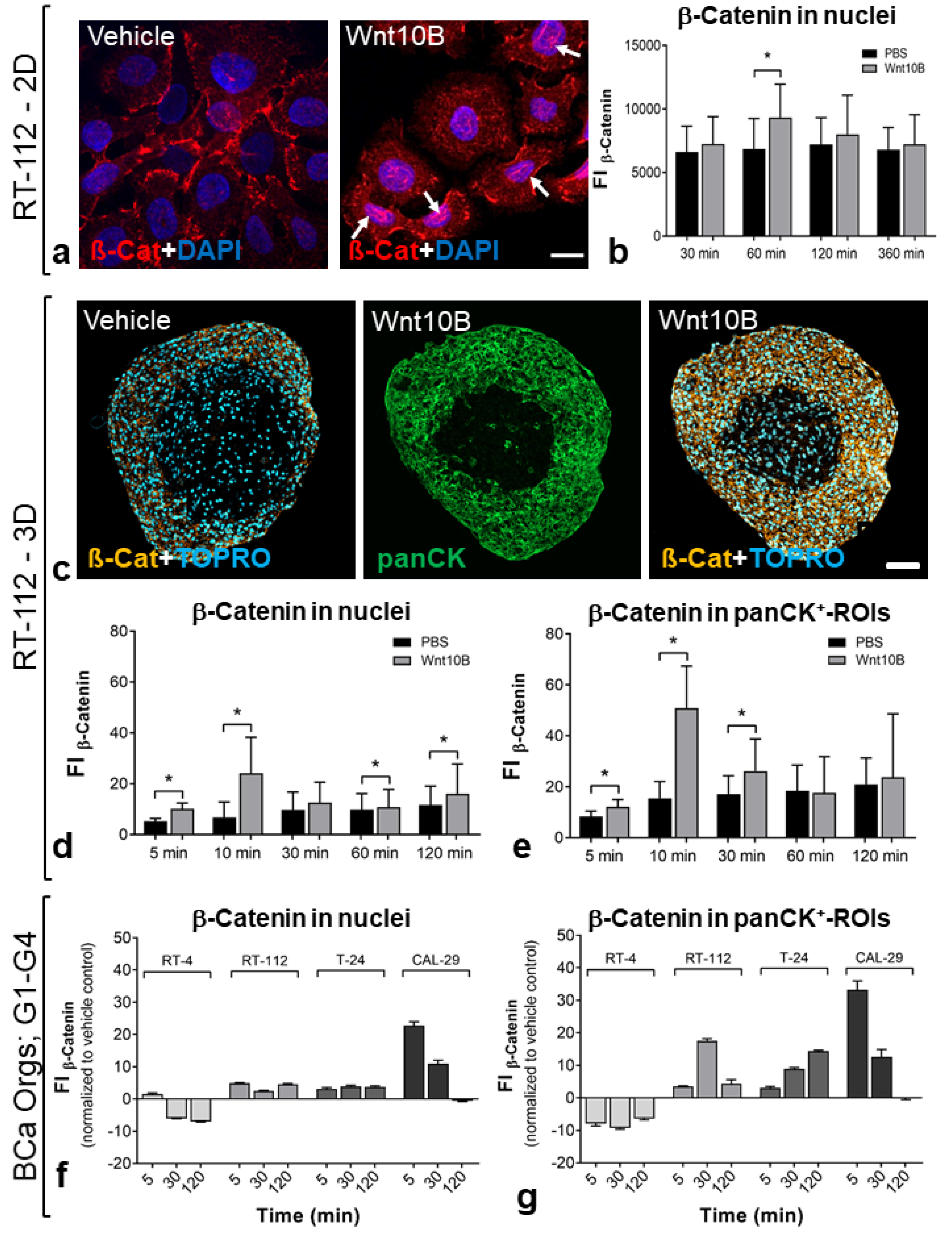 Cell Line-Based Human Bladder Organoids with Bladder-like Self ...