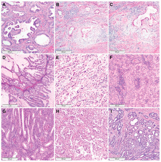 Histologia Da Endocervice
