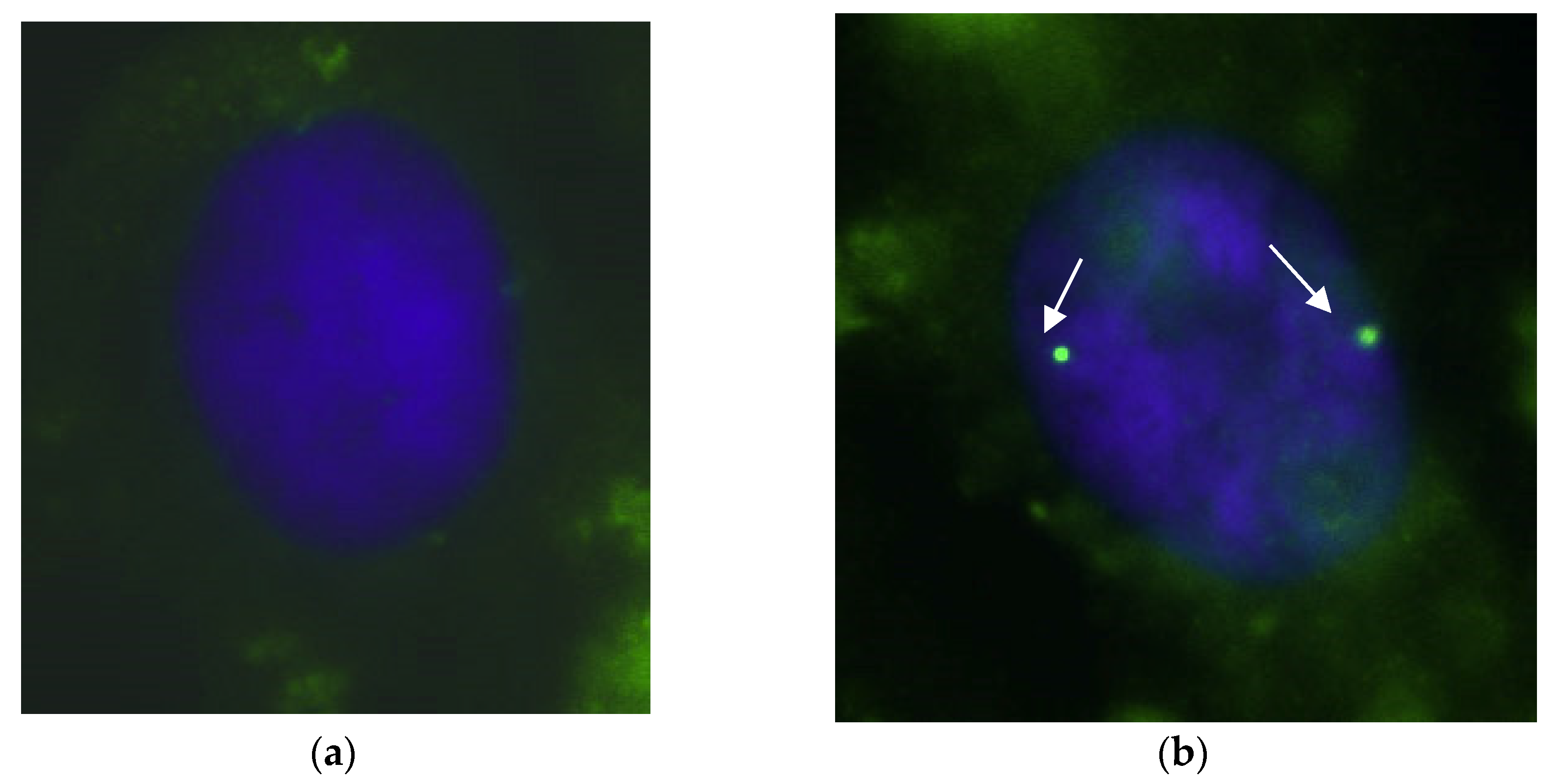 Development of 2′-O-Methyl and LNA Antisense Oligonucleotides for SMN2 ... Development of 2′-O-Methyl and LNA Antisense Oligonucleotides for SMN2 ...