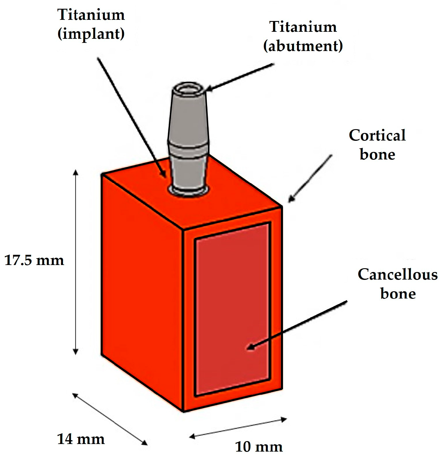Crestal and Subcrestal Placement of Morse Cone Implant–Abutment ...