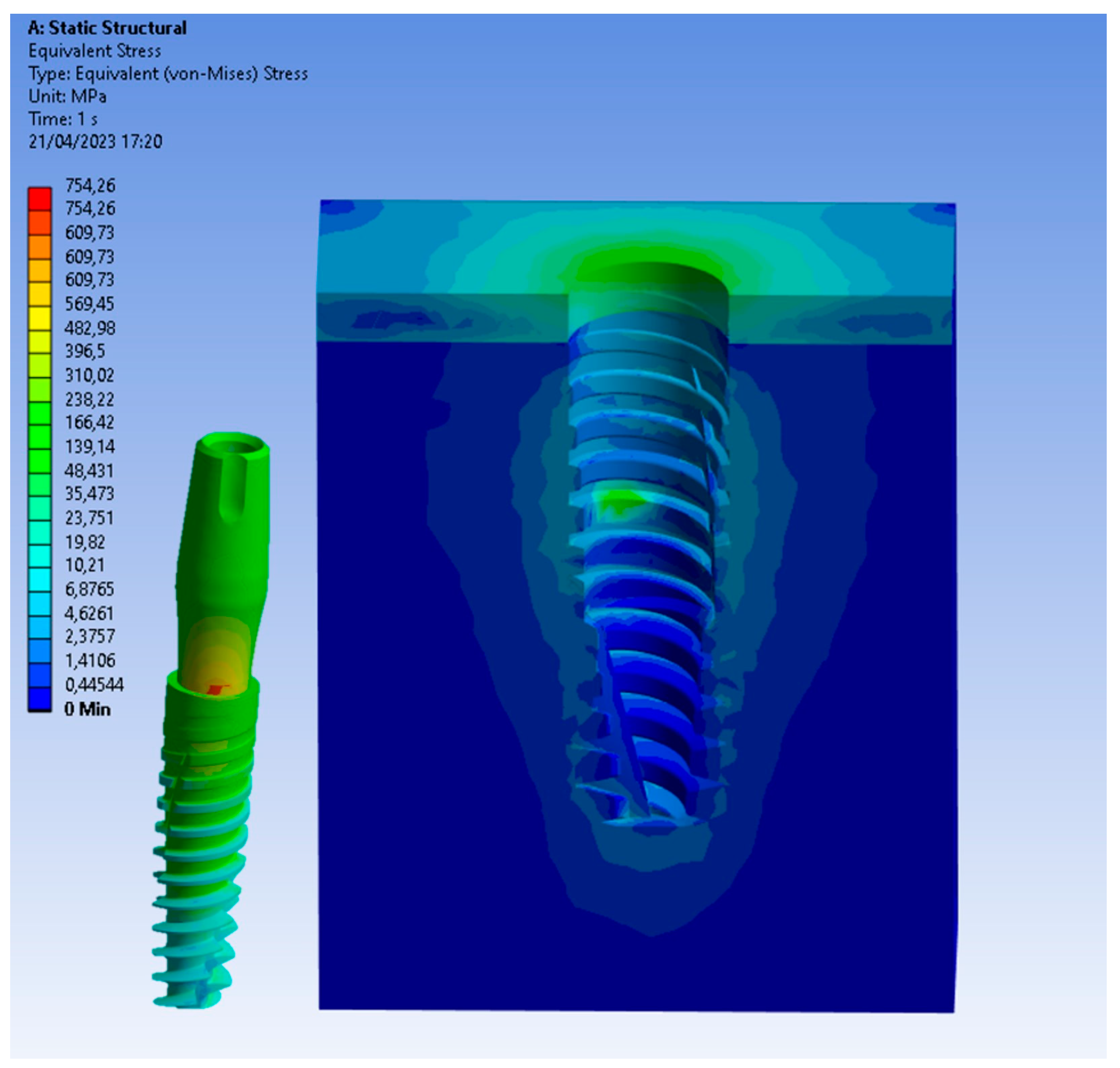 Crestal and Subcrestal Placement of Morse Cone Implant–Abutment ...
