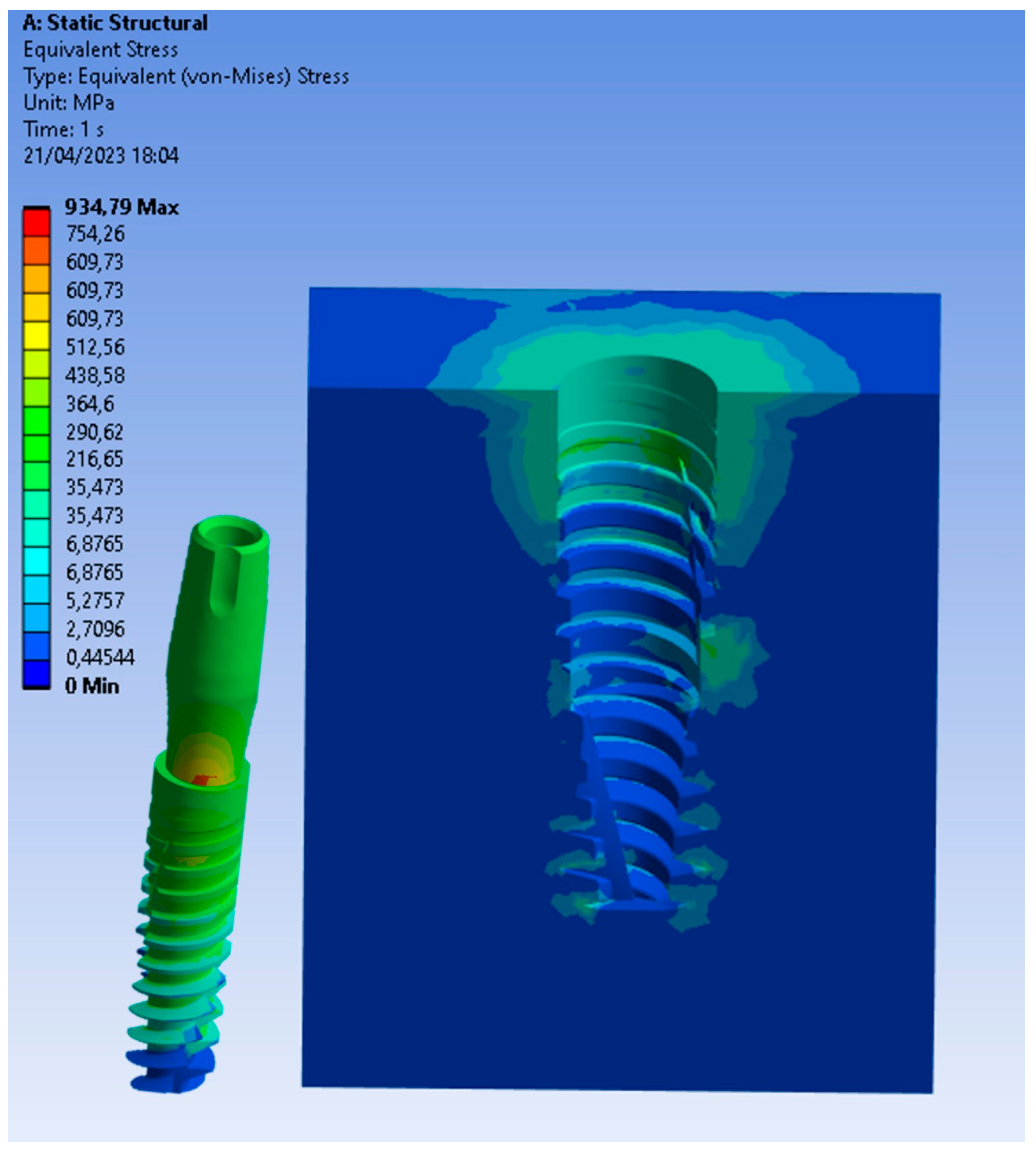 Crestal and Subcrestal Placement of Morse Cone Implant–Abutment ...