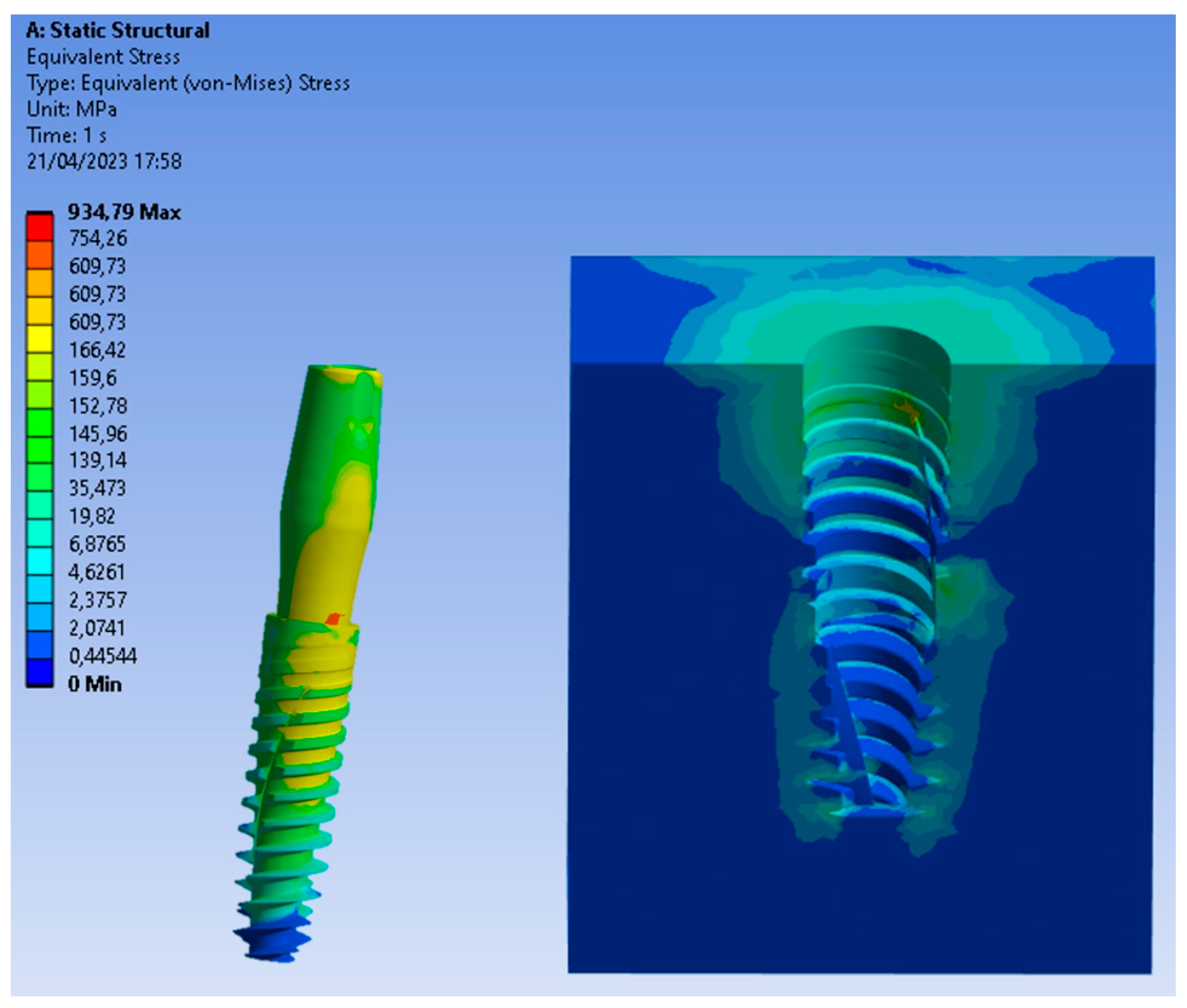 Biomedicines | Free Full-Text | Crestal and Subcrestal Placement of ...