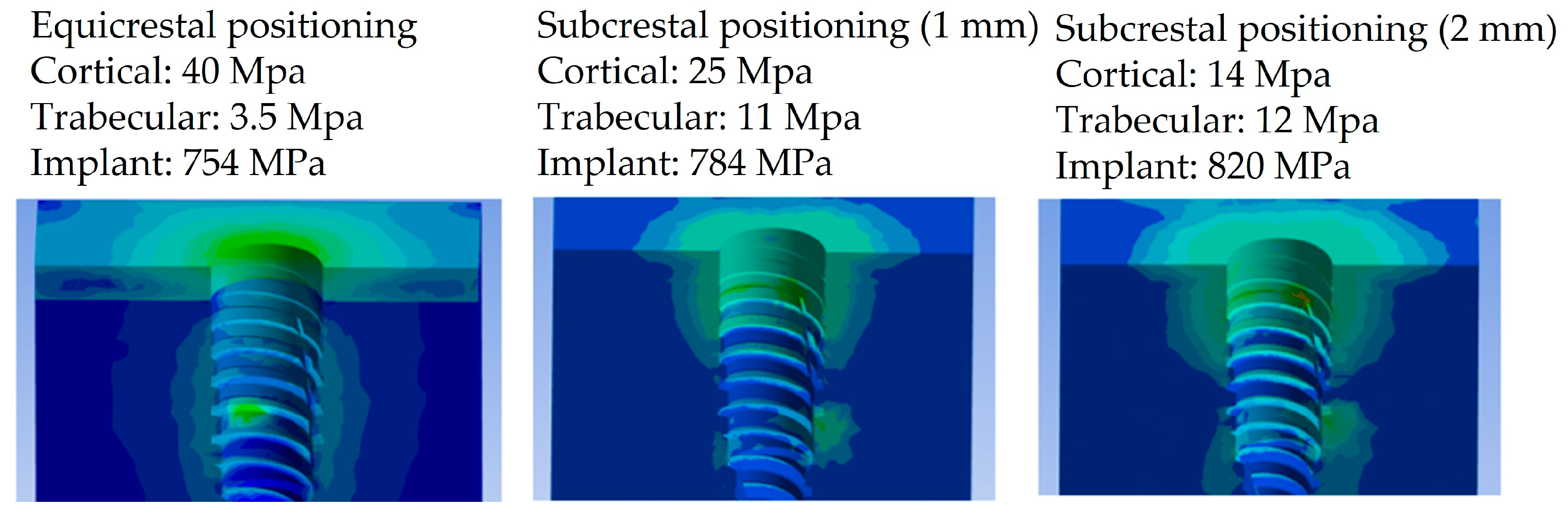 Biomedicines | Free Full-Text | Crestal and Subcrestal Placement of ...