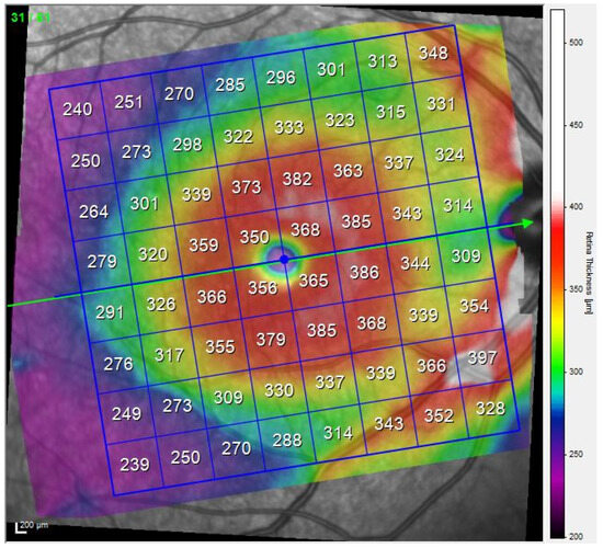 Biomedicines | Free Full-Text | Differential Study of Retinal ...