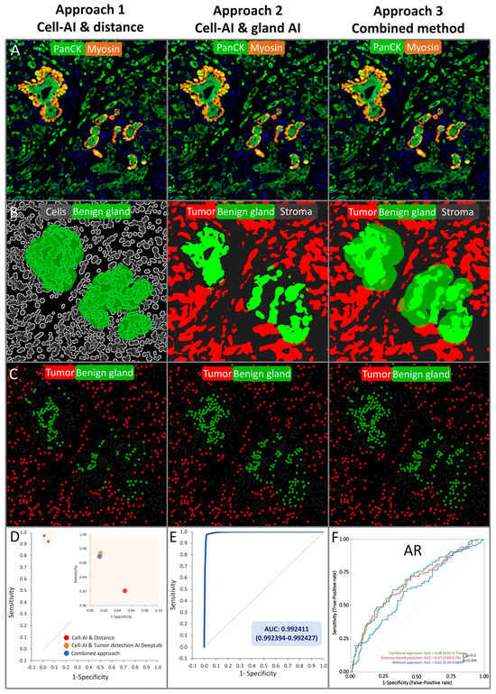 Automated Prognosis Marker Assessment in Breast Cancers Using BLEACH ...