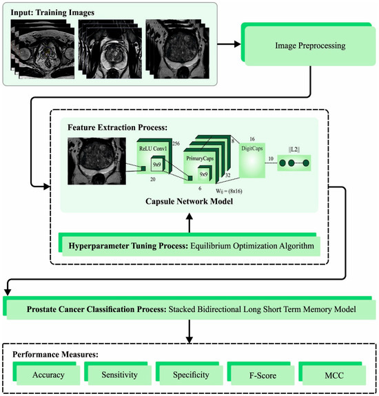 Equilibrium Optimization Algorithm with Deep Learning Enabled Prostate Cancer Detection on MRI ...