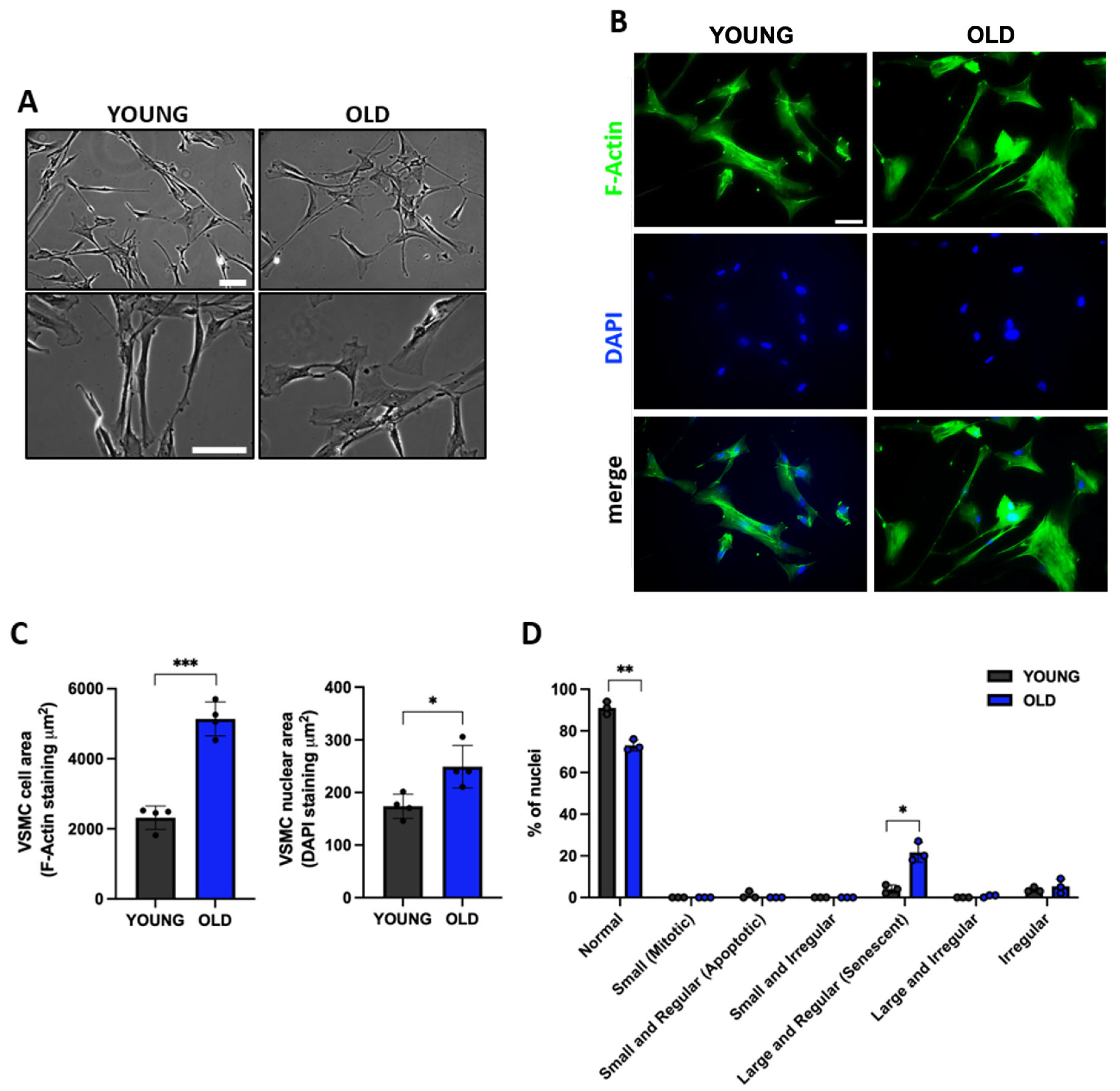 PURPL and NEAT1 Long Non-Coding RNAs Are Modulated in Vascular Smooth Muscle Cell Replicative ...