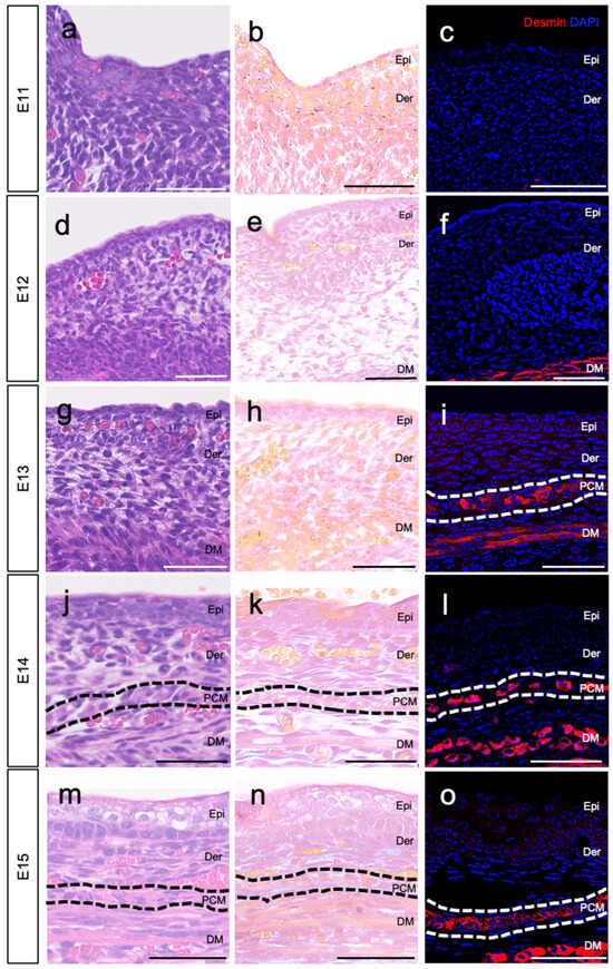 Regeneration of Panniculus Carnosus Muscle in Fetal Mice Is ...