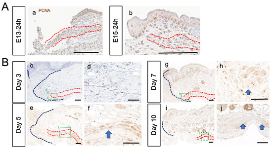 Regeneration of Panniculus Carnosus Muscle in Fetal Mice Is ...
