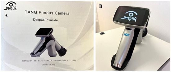 Diagnostic Accuracy of Hand-Held Fundus Camera and Artificial ...