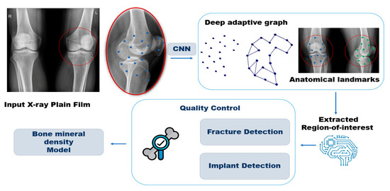 Application of Artificial Intelligence at All Stages of Bone Tissue ...