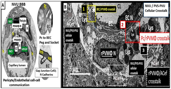A Closer Look at the Perivascular Unit in the Development of Enlarged ...