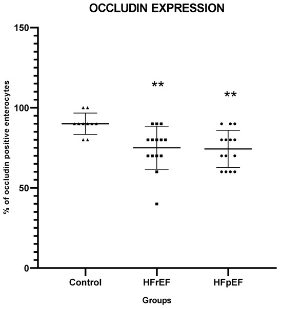 Biomedicines | Free Full-Text | Altered Expression of Intestinal Tight ...