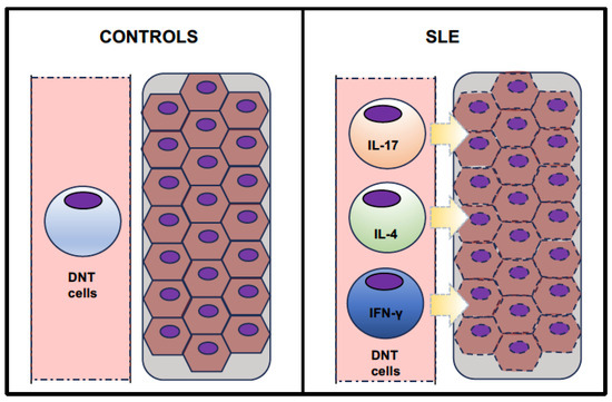 Double-Negative T (DNT) Cells in Patients with Systemic Lupus Erythematosus