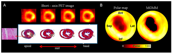 Automatic Quantitative Assessment for Diagnostic and Therapeutic ...