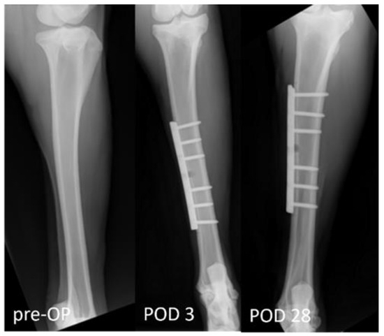 Refinement in Post-Operative Care for Orthopaedic Models: Implementing ...