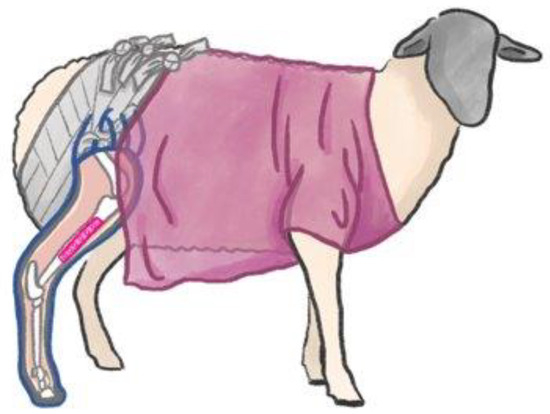 Refinement in Post-Operative Care for Orthopaedic Models: Implementing ...