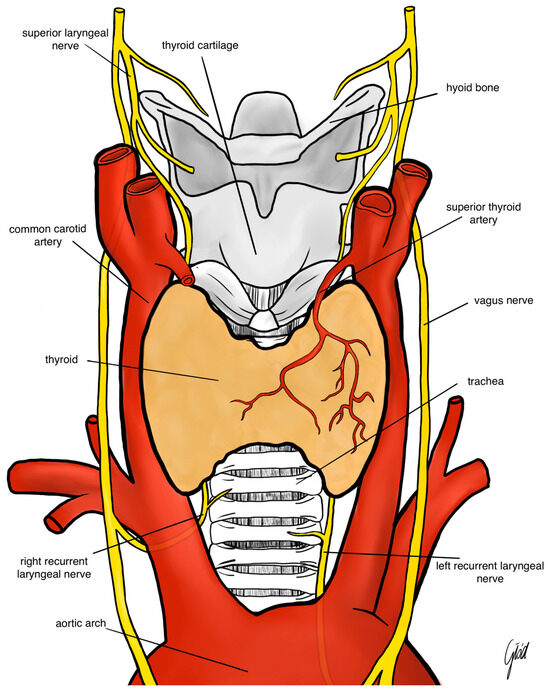 Current Knowledge on the Use of Neuromonitoring in Thyroid Surgery