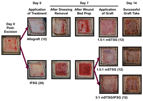 Comparison of Intact Fish Skin Graft and Allograft as Temporary ...