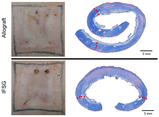 Comparison of Intact Fish Skin Graft and Allograft as Temporary ...