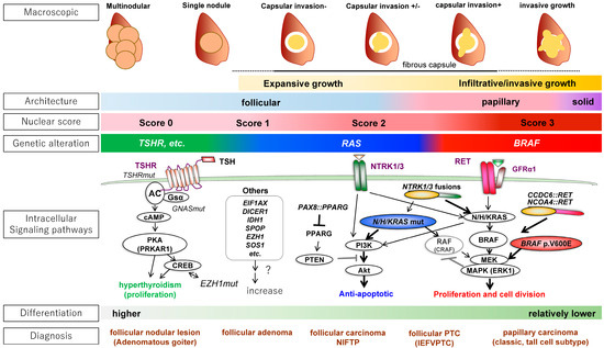 Molecular Pathology of Thyroid Tumors: Essential Points to Comprehend ...