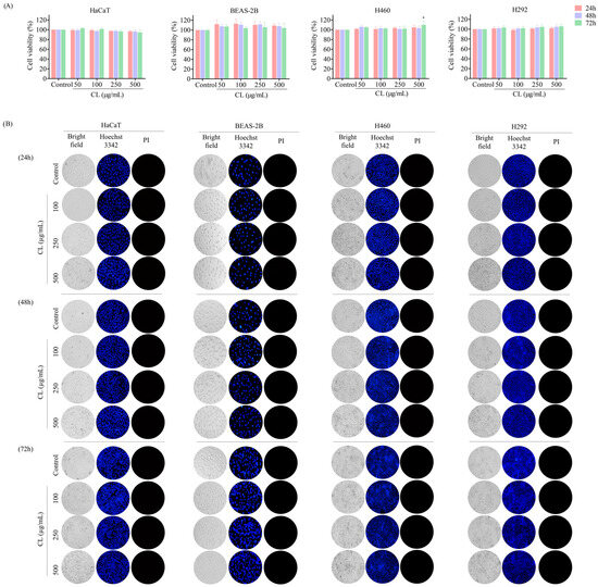Shrimp Lipids Inhibit Migration, Epithelial–Mesenchymal Transition, and ...
