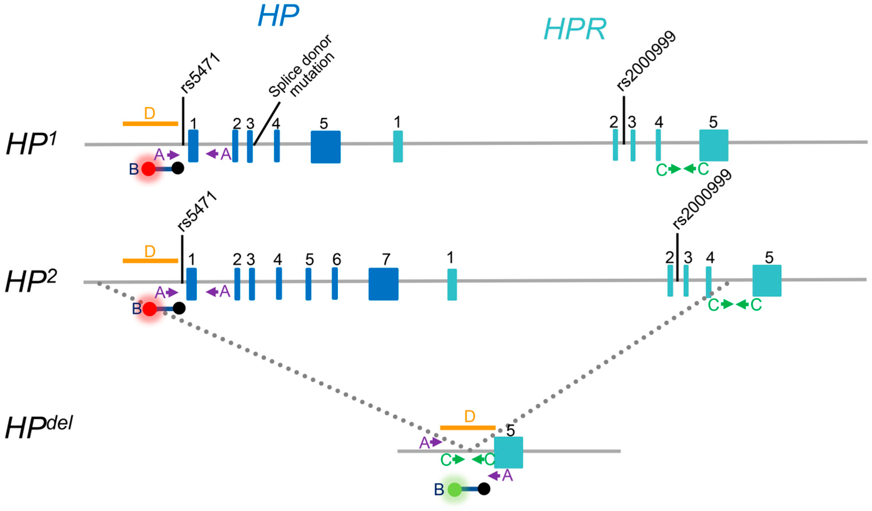 Identification and Diagnosis of Complete Haptoglobin Gene Deletion, One ...