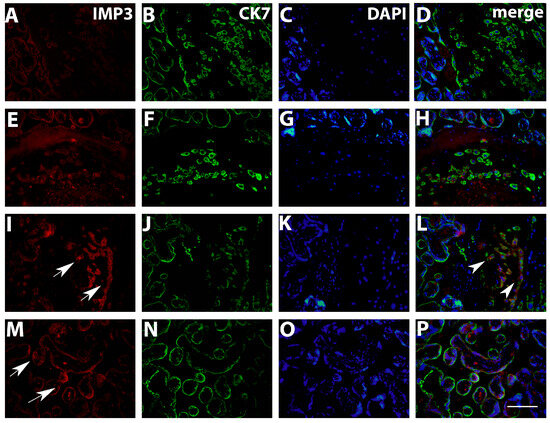 Expression of IMP3 and LIN28A RNA-Binding Proteins in Placentas of ...