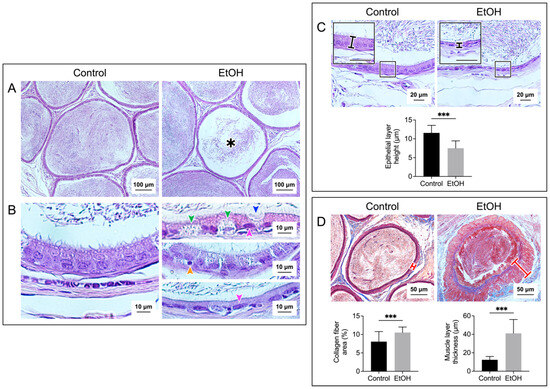 Rats Orally Administered with Ethyl Alcohol for a Prolonged Time Show ...