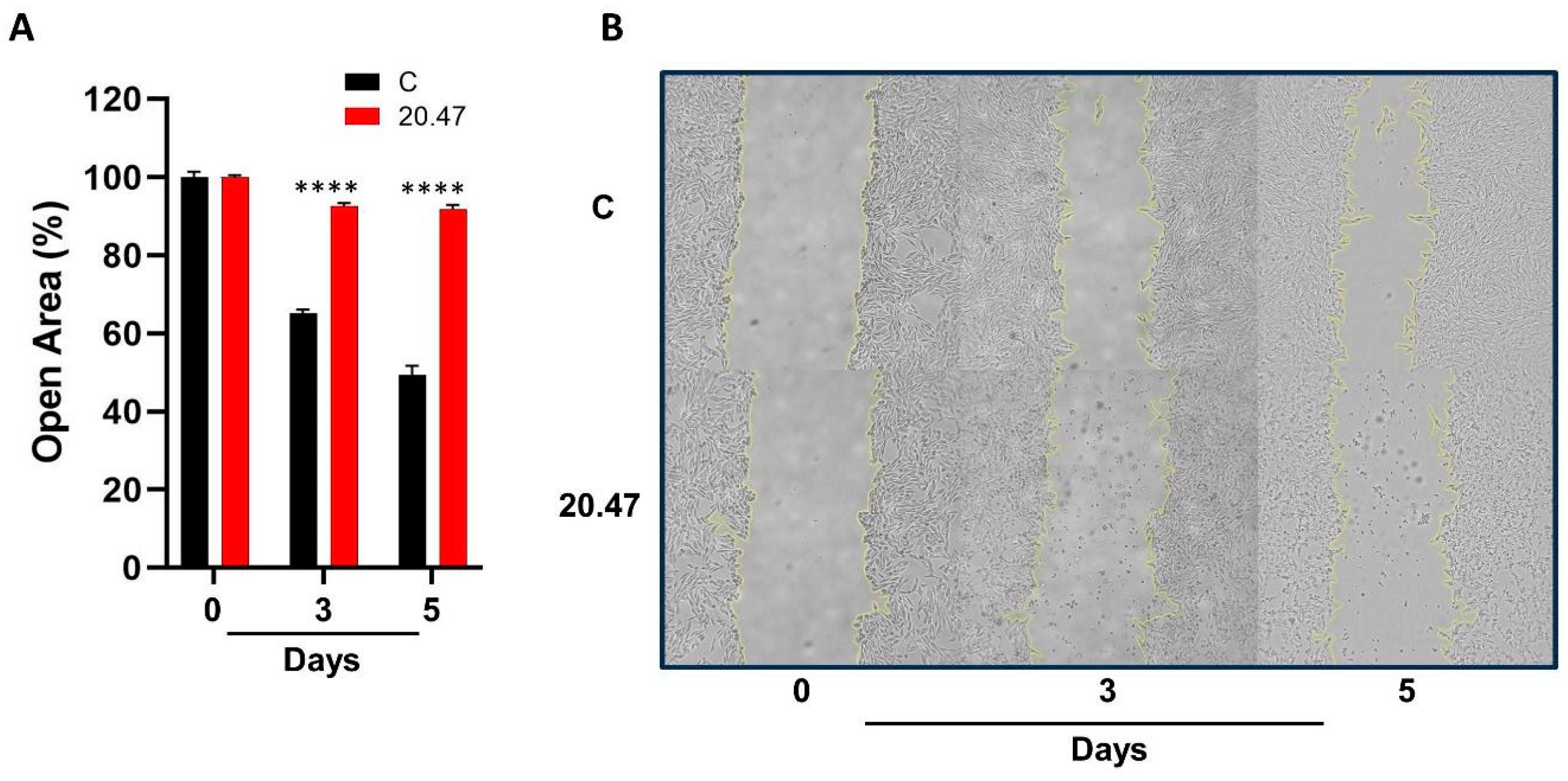 Ibrutinib Modulates Proliferation, Migration, Mitochondrial Homeostasis ...