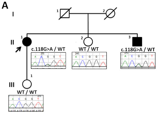 Novel ATP2A2 Gene Mutation c.118G>A Causing Keratinocyte and ...