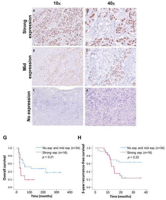 The Expression of TP63 as a Biomarker of Early Recurrence in Resected ...