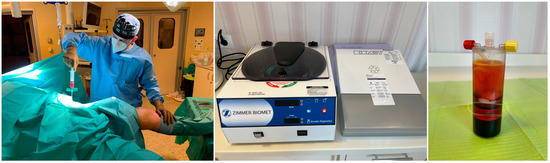 Biomedicines | Free Full-Text | A New Approach to Postoperative ...