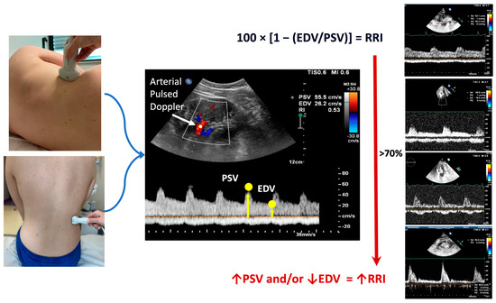 Biomedicines | Free Full-Text | Renal Arterial and Venous Doppler in Cardiorenal Syndrome ...