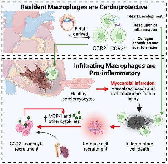 Biomedicines | Free Full-Text | The Multifaceted Nature of Macrophages in Cardiovascular Disease