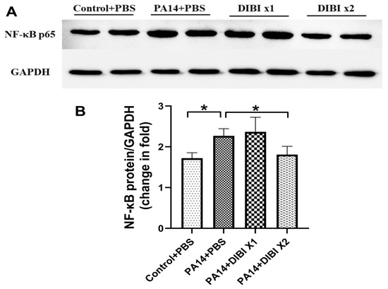 The Hydroxypyridinone Iron Chelator DIBI Reduces Bacterial Load and ...
