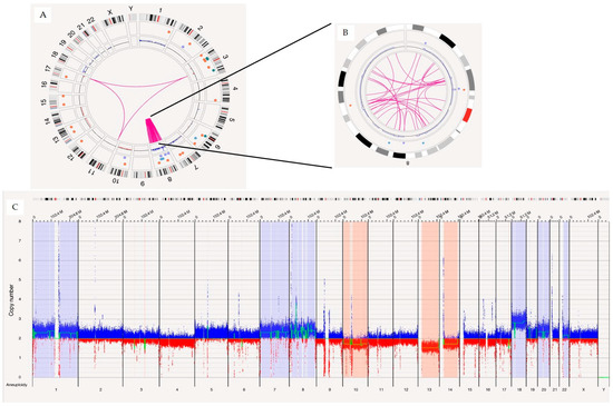 Clinical Utility of Optical Genome Mapping for Improved Cytogenomic ...