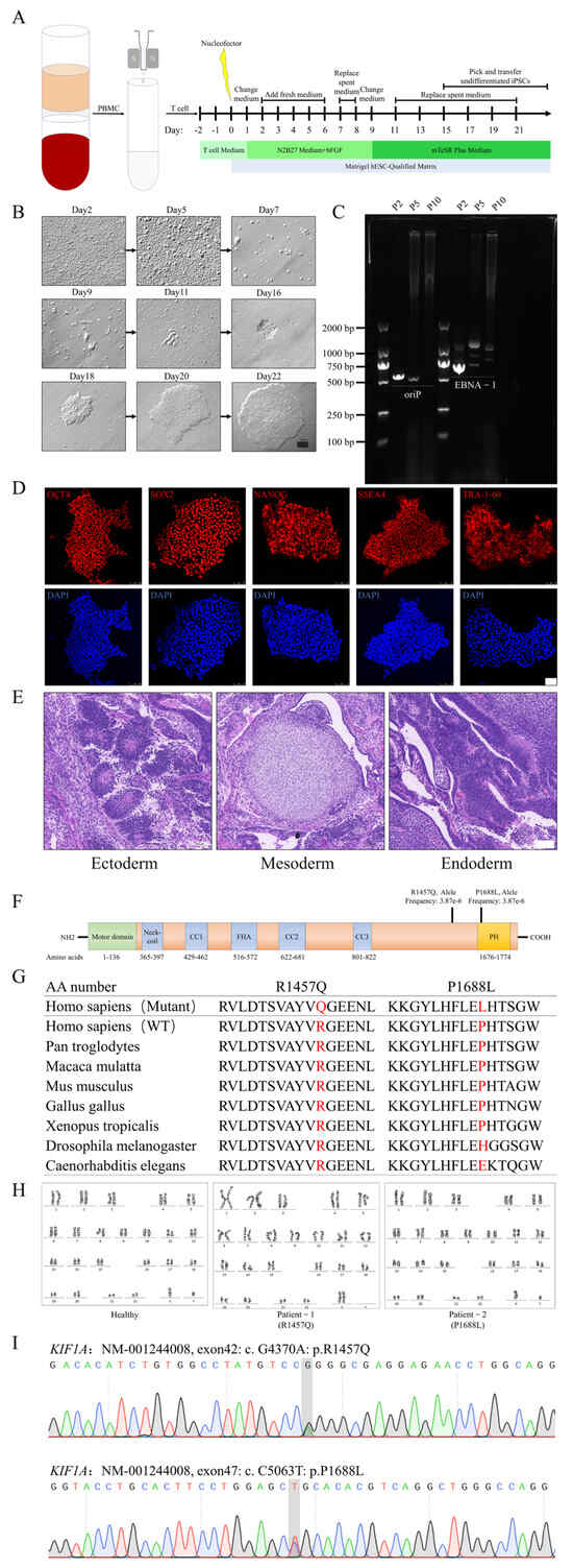 KIF1A, R1457Q, and P1688L Mutations Induce Protein Abnormal Aggregation ...