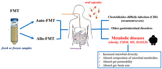 Biomedicines | Free Full-Text | The Role of Fecal Microbiota ...