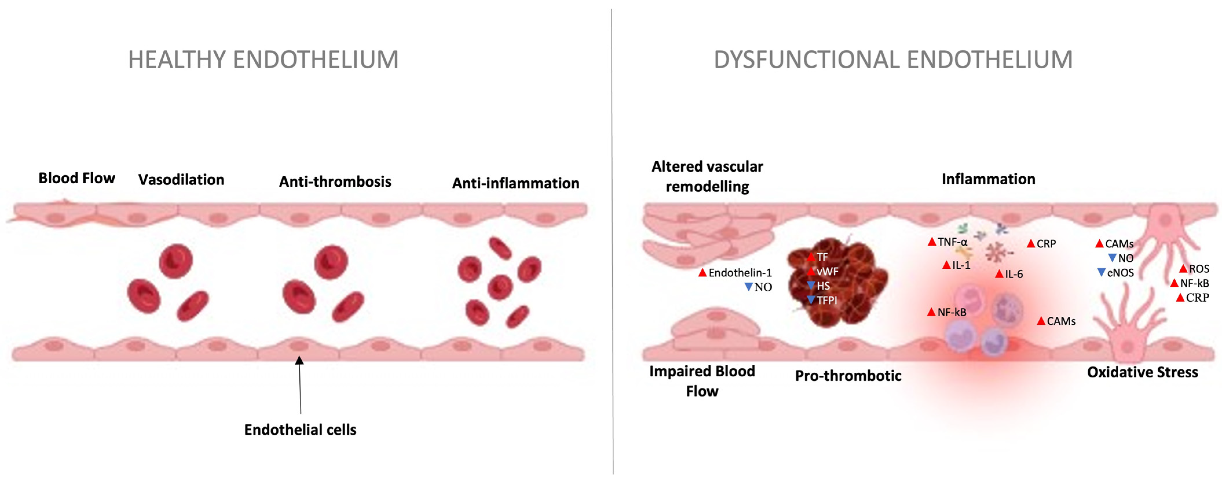 Biomedicines | Free Full-Text | Decoding Pulmonary Embolism ...