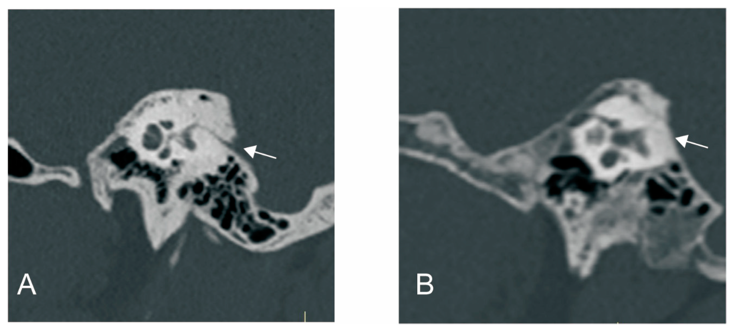Biomedicines | Free Full-Text | Angular Trajectory of the Vestibular ...