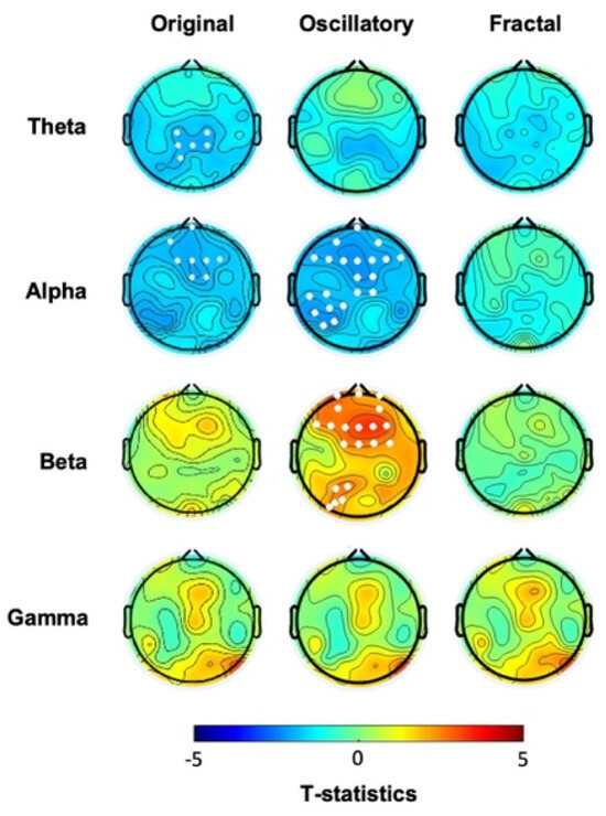 Resting-State EEG Alterations of Practice-Related Spectral Activity and Connectivity Patterns in ...