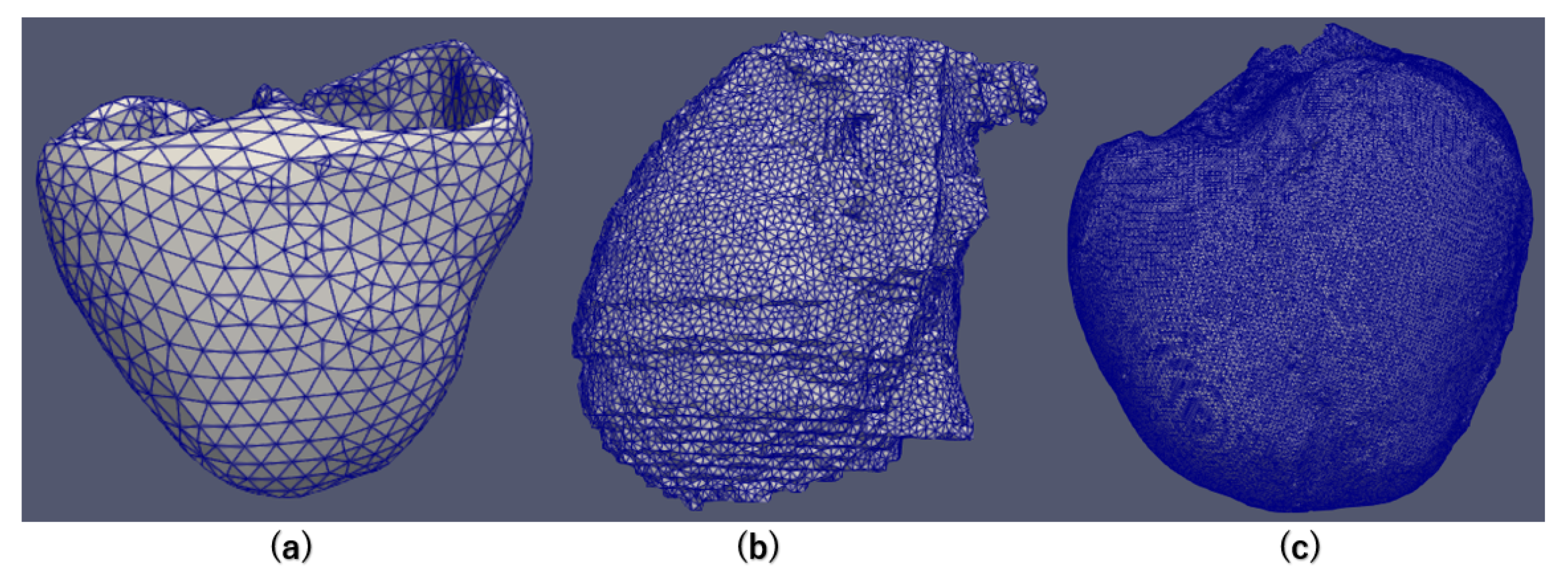 Parallelization of Three Dimensional Cardiac Simulation on GPU